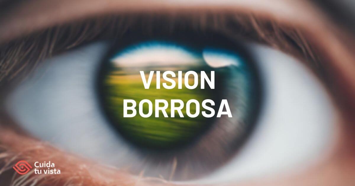 Visión Borrosa. Causas, síntomas y tratamiento