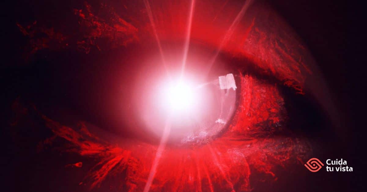 Terapia Luz Roja ? Qué es, Beneficios y RIESGOS